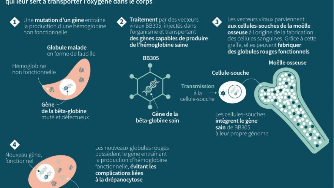 Comment la thérapie génique a transformé la vie de patients souffrant ...