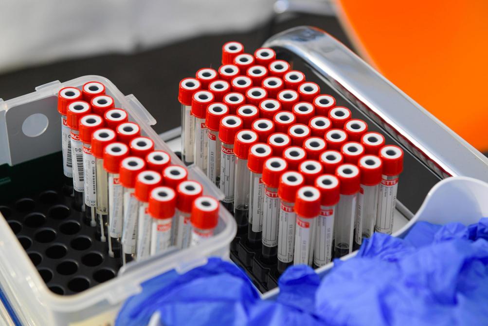 Covid-19: un nouveau variant surveillé de près par l’OMS