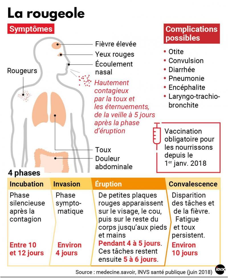 Rougeole : de nombreux cas signalés en Europe